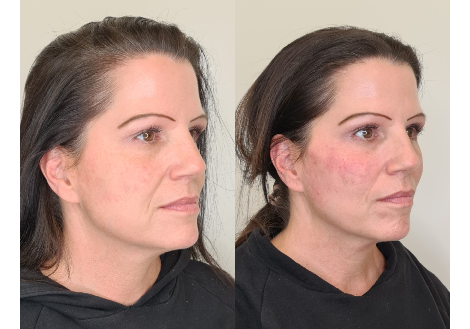 Galleri före och efter bilder